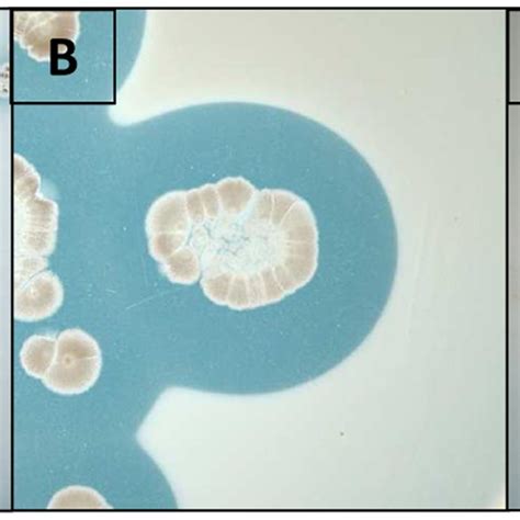 Detection Of Extracellular Phb Depolymerase Activity In Streptomyces Download Scientific