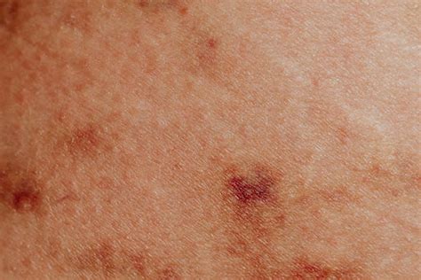 Gabapentin 800mg How To Identify Your Pills Doctronic