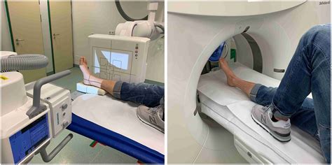 3d Cone Beam Ct Of The Ankle Using A Novel Twin Robotic X Ray System Assessment Of Image