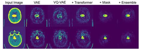 Residual Maps On The Synthetic Dataset From The Variational Autoencoder Download Scientific