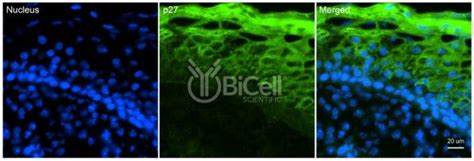 Cdkn1b P27 Or P27kip1 Or Kip1 Antibody Bicell Scientific®