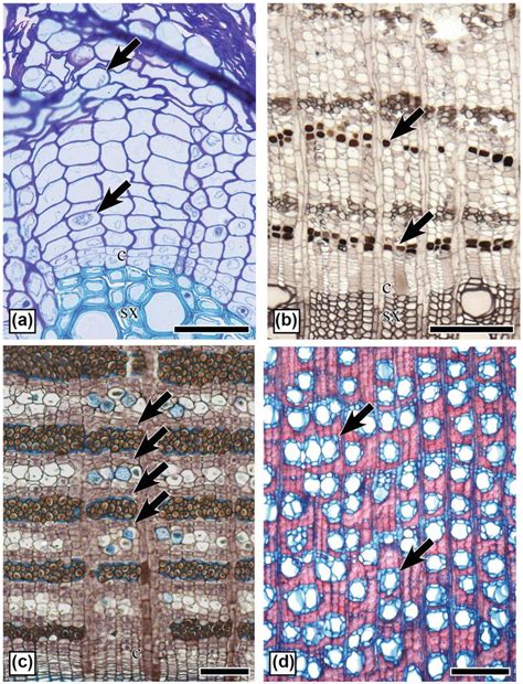 Phloem Cell Types Structure And Commercial Uses Intechopen