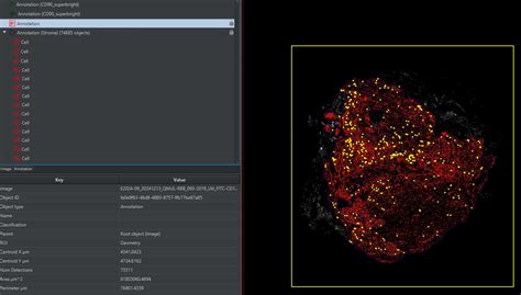 How To I Transfer An Annotation In Qupath Image Analysis Imagesc Forum
