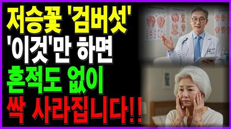 집에서 저승꽃 검버섯 없애는 기적의 방법 피부과 갈 필요 없습니다ㅣ기미 검버섯 흔적도 없이 싹 지웁니다ㅣ시니어건강 ㅣ노후건강 ㅣ노후지혜 Youtube