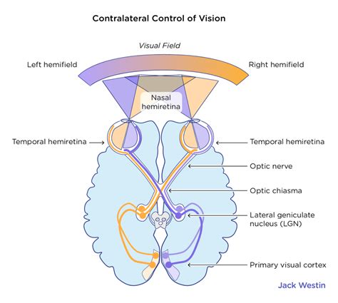 Visual Processing Crowleys Opticians