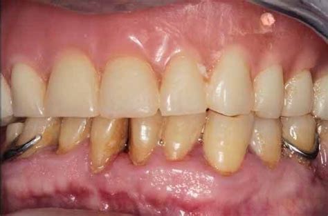Modjaw™ Occlucurve™ The 4d Occlusal Curve