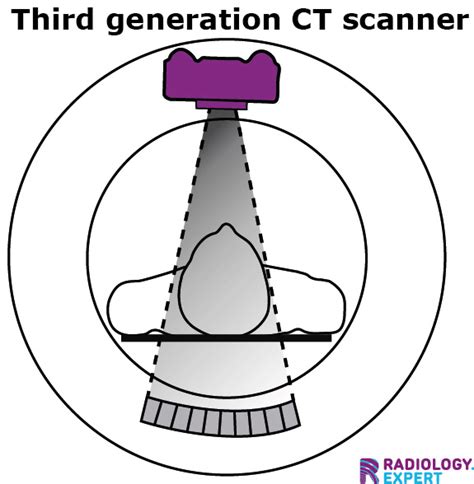 X Ray Ct Technique