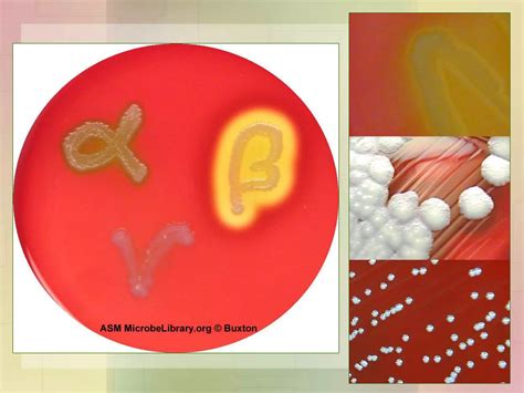 Streptococcus And Enterococcus By Dr Rakesh Prasad Sah Pptx Streptococcus And Enterococcus By Dr Rakesh Prasad Sah Pptx