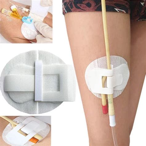 Body Surface Catheter Fixation Devices Non Woven Fabric Infusion Tube Fixed Dh £2 99 Picclick Uk