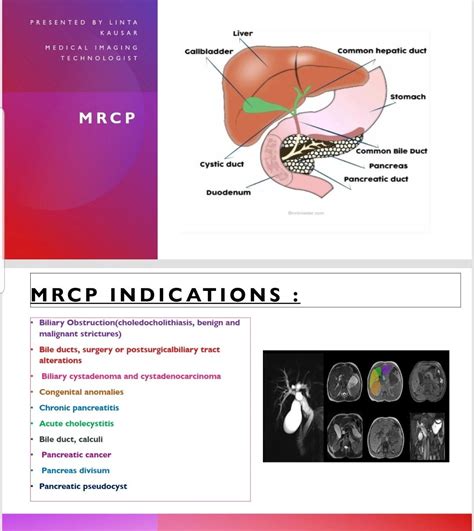 Linta Kausar On Linkedin Mri Mrcp Radiology Medicalimaging