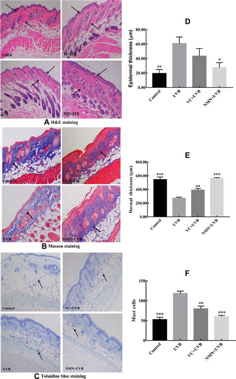 Figure 2 From β Nicotinamide Mononucleotide Nmn Administrated By