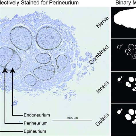 Define Sample Specific Models With Segmented Nerve Images We Segmented Download Scientific