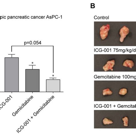Combination Icg 001 And Gemcitabine Treatment Suppresses Pancreatic