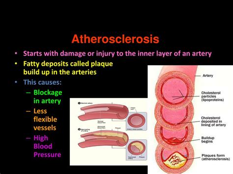 Ppt Circulatory System Disorders Powerpoint Presentation Free