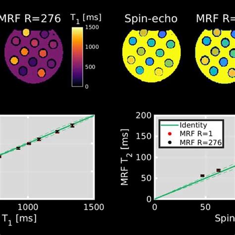 Accuracy And Precision Analysis Of Mrf Parameter Quantification In A