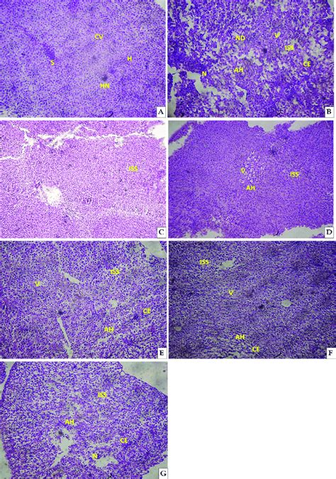 Photomicrographs 2 Mm Of The Hande Stained Liver Tissue Of Cyprinus