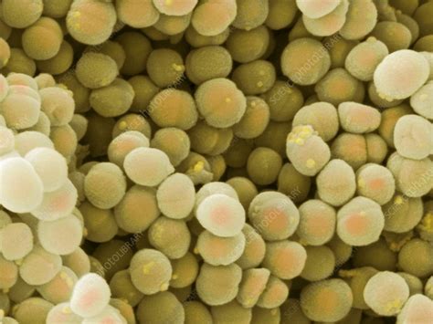 Lactococcus Sp Bacteria Sem Stock Image C0149334 Science