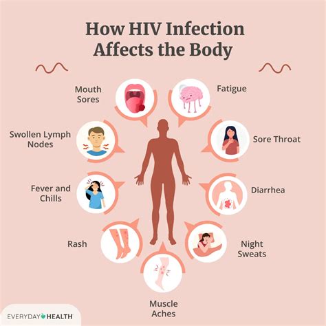 Acute Hiv Symptoms Understanding Hiv Rash Symptoms Treatment And