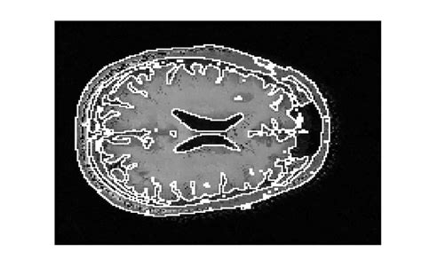 Segmentation Of The Reference Image A Without Coupling Download