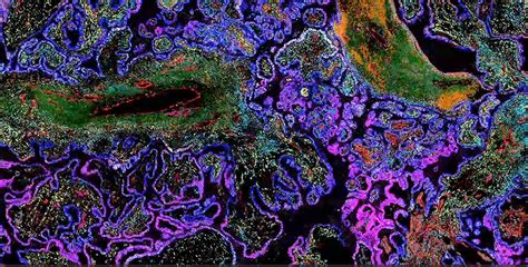 How Spatial Biology Is Revolutionizing Single Cell Genomics