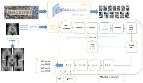 Estimation Of Acetabular Version From Anteroposterior Pelvic Radiograph