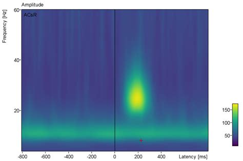 Besa® Brain Electrical Source Analysis Besa Connectivity Features In Besa Connectivity 2 0