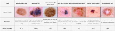 Example Images Along With Their Detailed Information From The Isic 2018