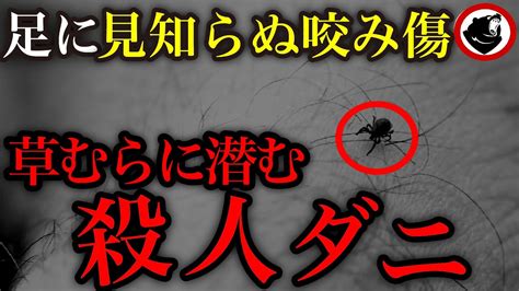 【世界初感染】知らぬ間にマダニに噛まれた女性。3mm程度のマダニに隠された最恐の真実とは…「マダニ媒体感染症死亡事件」 Youtube