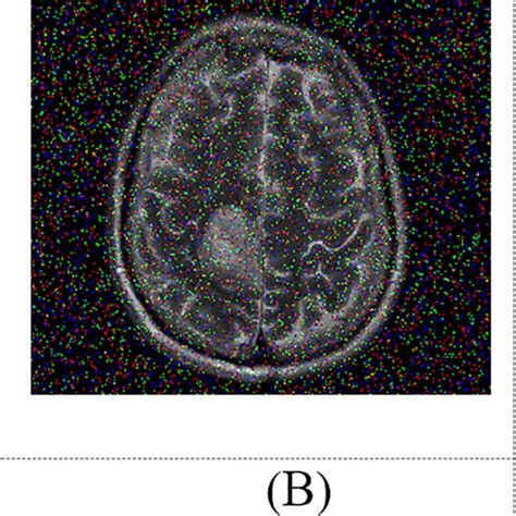 Image Noise Elimination A Original Image B Image After 25 Density Download Scientific