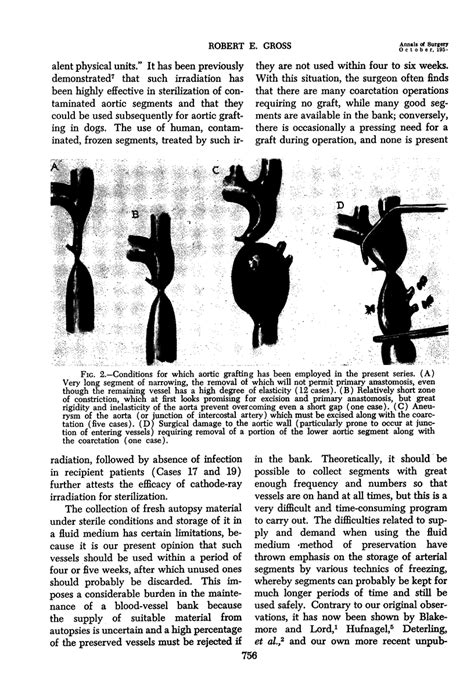 Treatment Of Certain Aortic Coarctations By Homologous Grafts A Report