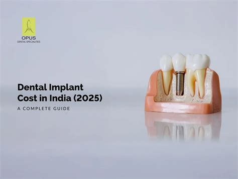 Dental Implant Cost In India 2025 A Complete Guide