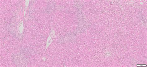 Human Liver Tissue Non Cancer Ffpe Sections