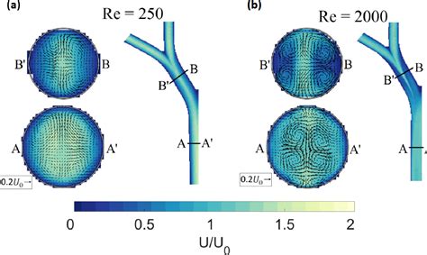 Figure 4 From Three Dimensional Steady And Oscillatory Flow In A Double Bifurcation Airway Model