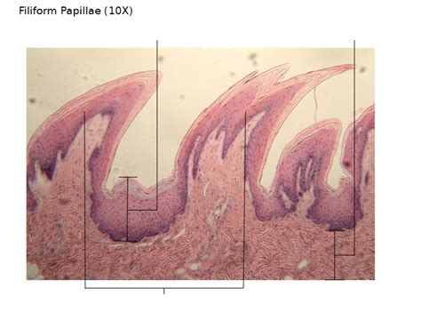 Filiform Papillae X Diagram Quizlet
