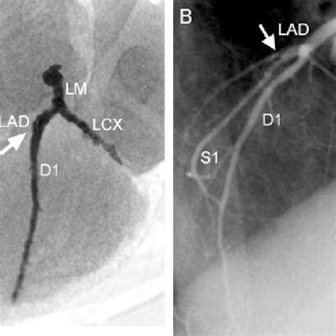 A Anterior View Of The Heart By Volume Rendering Algorithm Showing