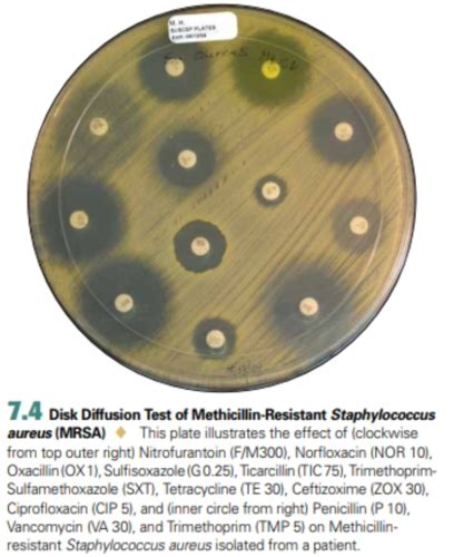 exam 2 part 2 flashcards quizlet