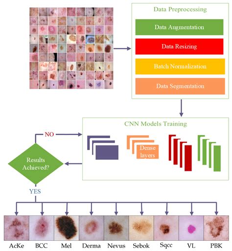 Enhancing Recognition And Categorization Of Skin Lesions With Tailored Deep Convolutional