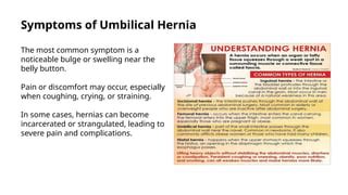 Umbilicalis Hernia About Hernia Of Umblical Pptx