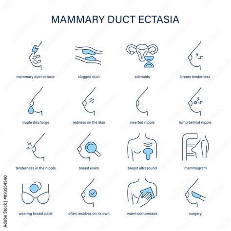 Mammary Duct Ectasia Symptoms Diagnostic And Treatment Vector Icons