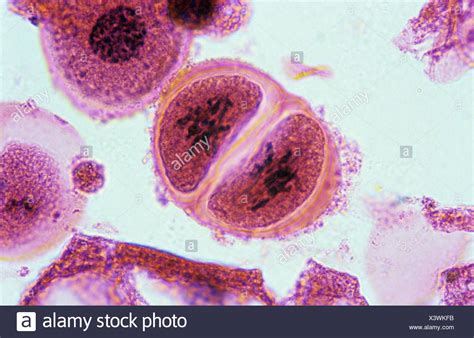 Mitosis Prophase Microscope De Histology Cell Division