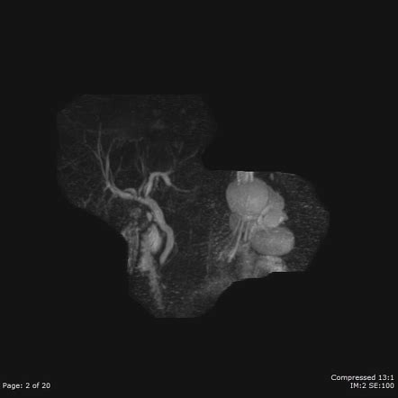 Image Radiopaedia Org