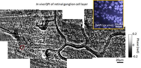 Quantitative Phase Imaging Research Projects Schallek Lab