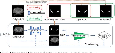 Figure 1 From Deep Generative Models For Automated Muscle Segmentation