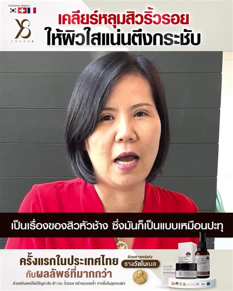 หลุมสิวตื้นขึ้นเยอะมากๆ จากสิวหัวช้างที่พร้อมปะทุ หลังจากที่ได้เจอ Y8 ทุกอย่างกระเจิงไปหมด 🚫โน