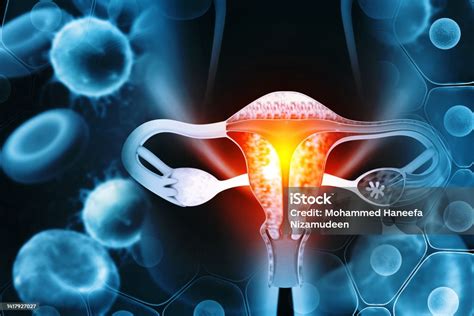Female Reproductive System Diseases Uterus Cancer And Endometrial