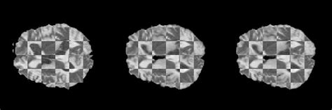 Figure 3 From Deformable Medical Image Registration Setting The State Of The Art With Discrete