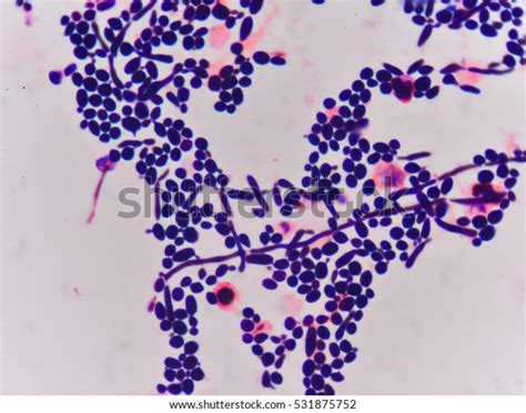 Стоковая фотография 531875752 Branching Budding Yeast Cells Pseudohyphae Gram Shutterstock