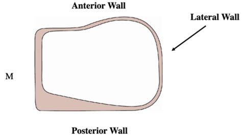 Tf Quad Socket Design Principles Flashcards Quizlet
