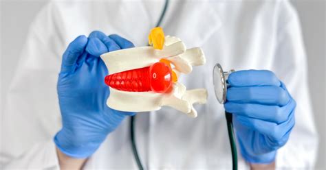 When To Consider Herniated Disc Surgery Dr Gerald Alexander