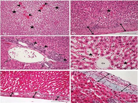 Group Tcdd A Sinusoidal Dilation And Vascular Congestion Download Scientific Diagram